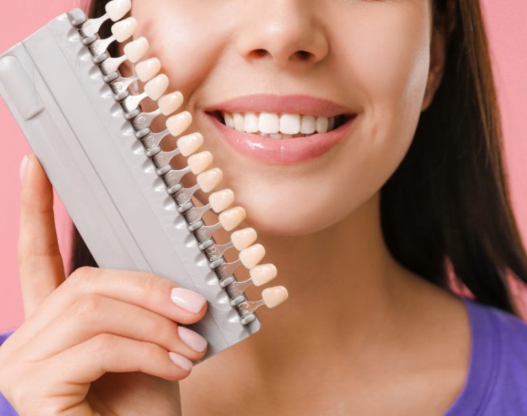 Smile Makeover Cost Guide: Veneers, Implants, and Orthodontics/Clear ...